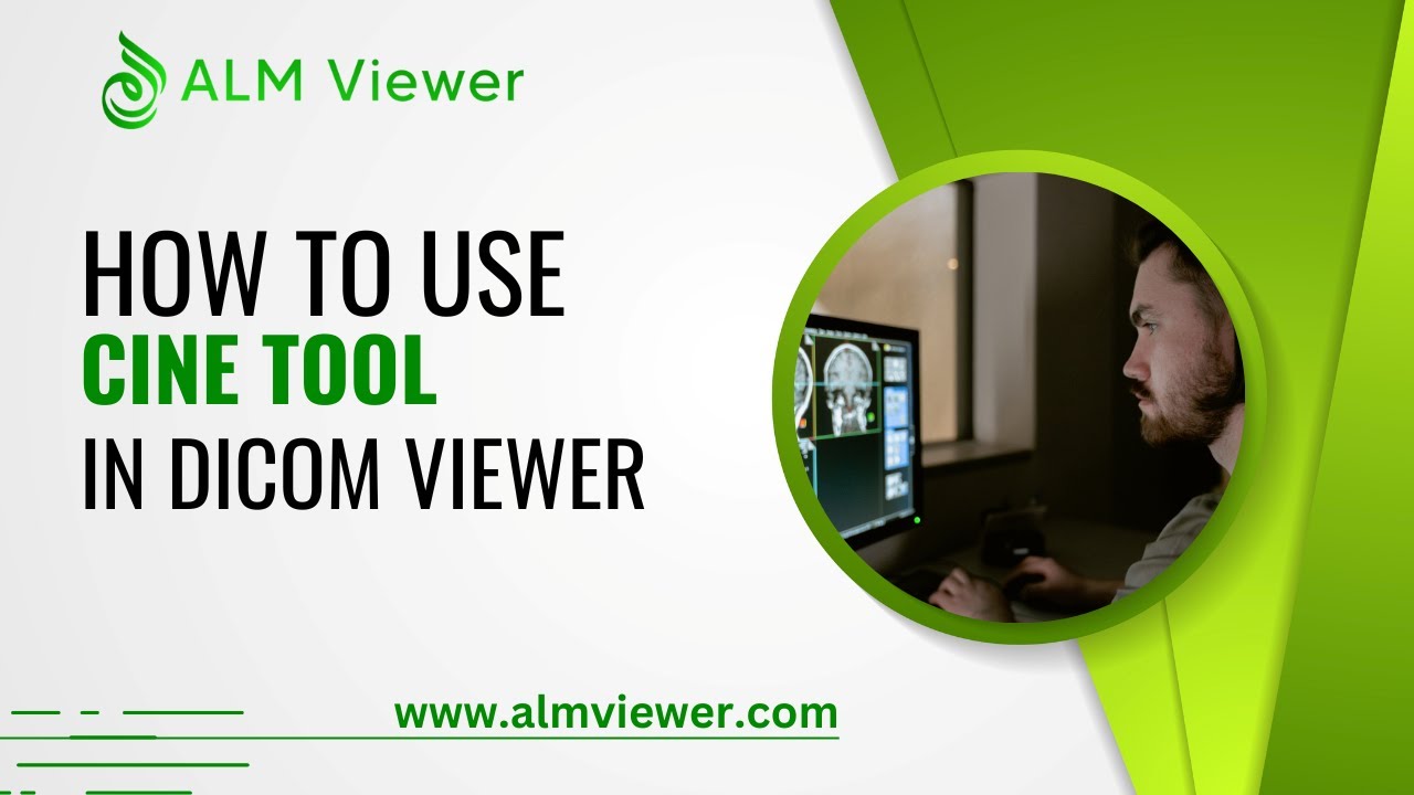 How to Use Cine Tool in Dicom Viewer - By Alm Viewer - YouTube