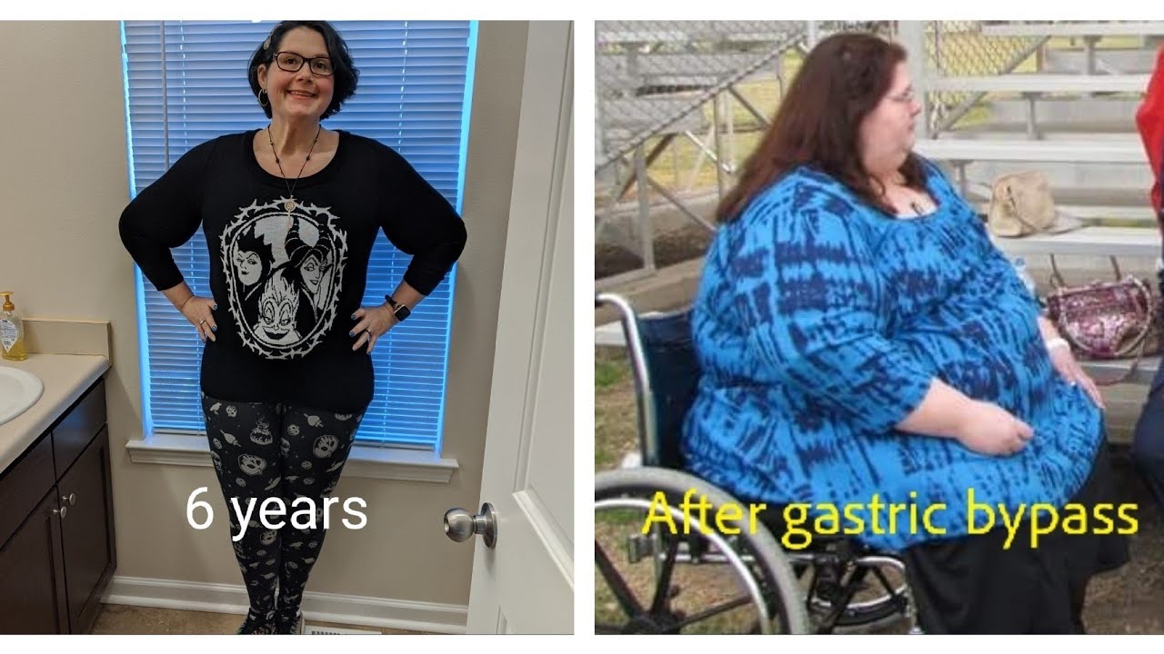 Welcome to my channel, Experiencing 6 years of bariatric living (new ...