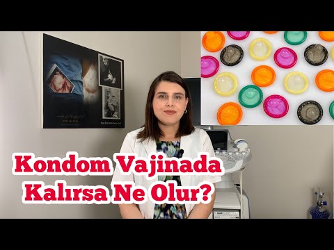 🟠 Kondom Vajinada Kalırsa Ne Olur? - Vajinada Prezervatif Kalması