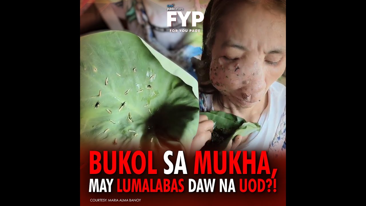Bukol sa mukha, may lumalabas daw na uod?! | FYP - YouTube