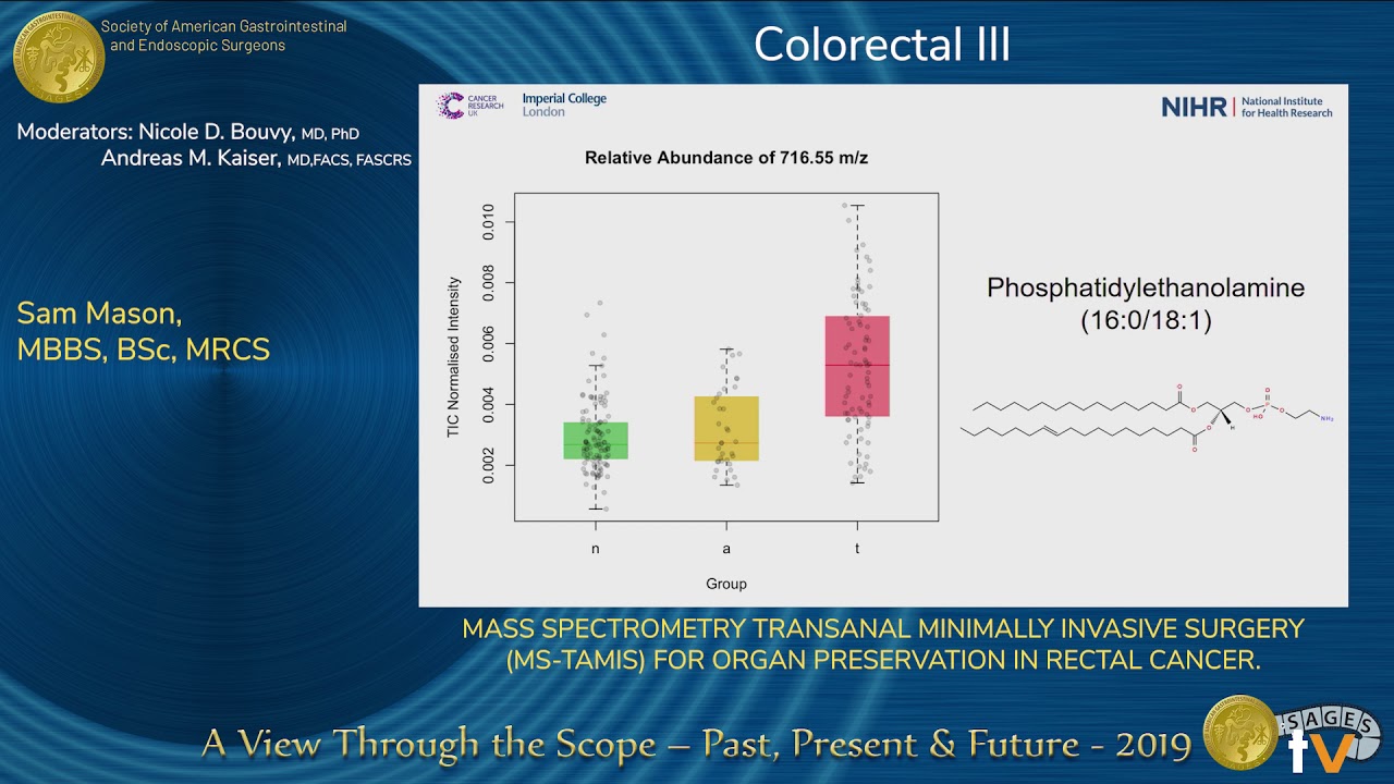 MASS SPECTROMETRY TRANSANAL MINIMALLY INVASIVE SURGERY (MS-TAMIS) - YouTube