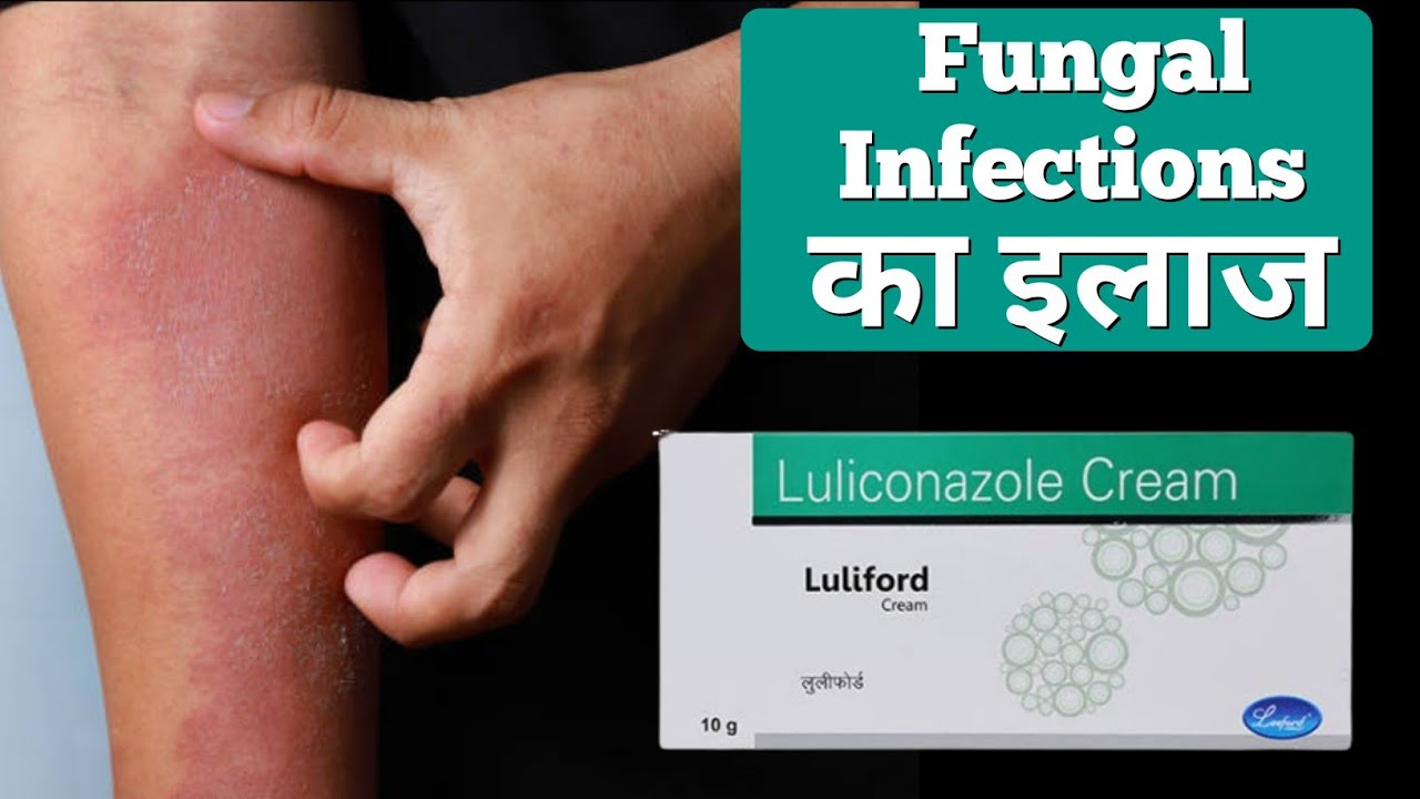 Luliford Cream Uses Doses Benefits And Side-Effects By A K Pharma ...