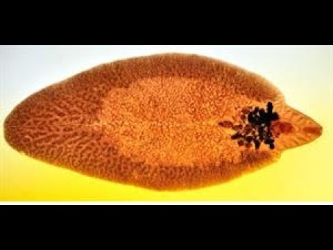 Жизненный цикл печёночного сосальщика / Qaraciyər sorucusunun həyat ...