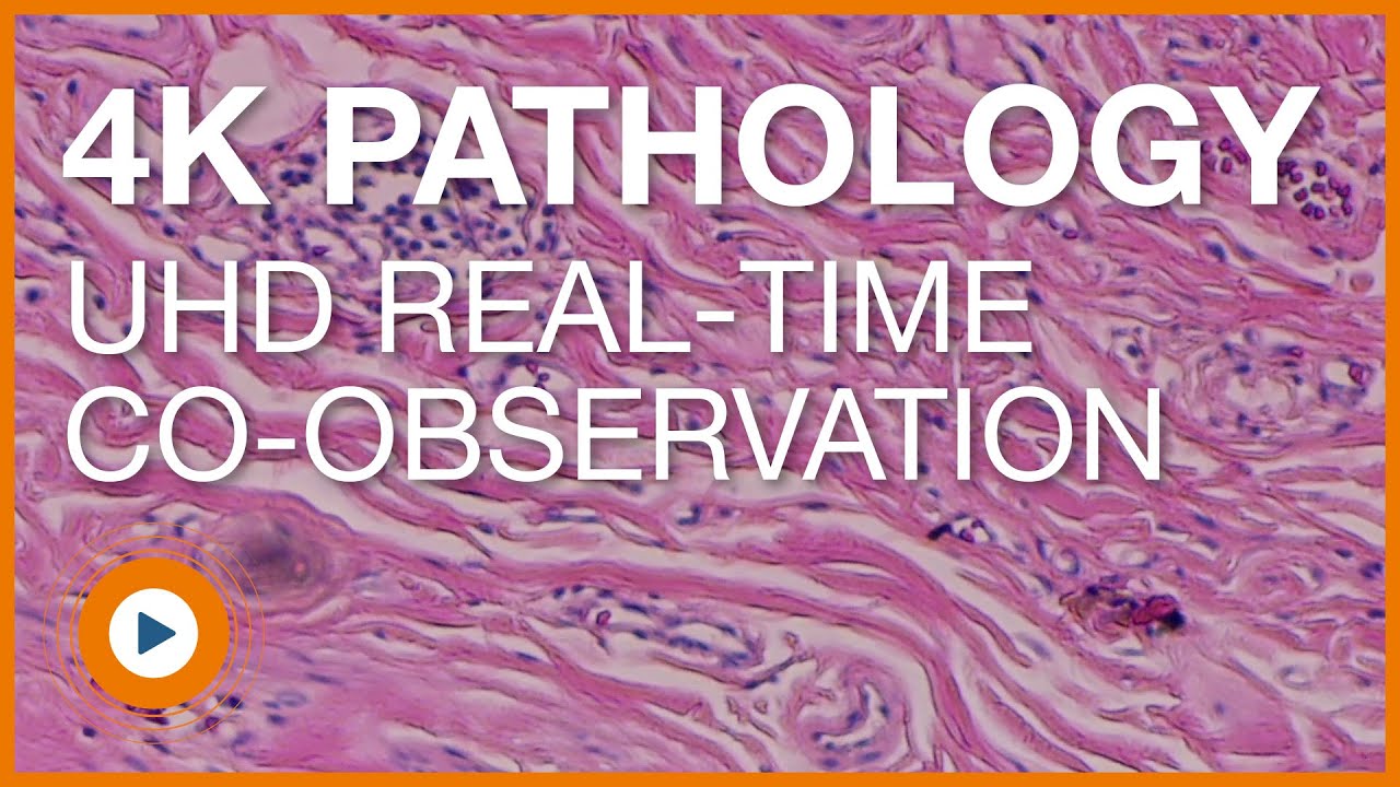 Clinical Pathology Video in 4K Ultra HD - YouTube