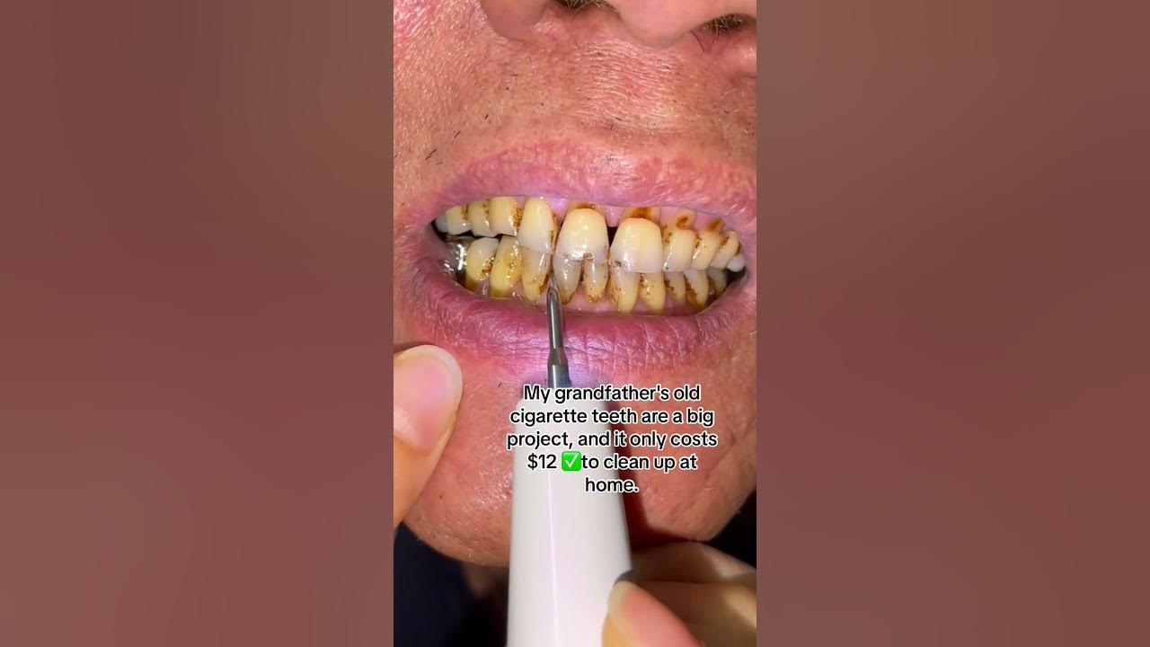 Grandpa's teeth cleaning trick for just $12! #oralhygiene - YouTube