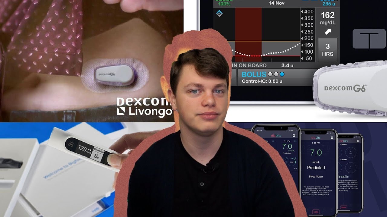 January Diabetes Technology Report: ControlIQ is here; Dexcom+Livongo ...