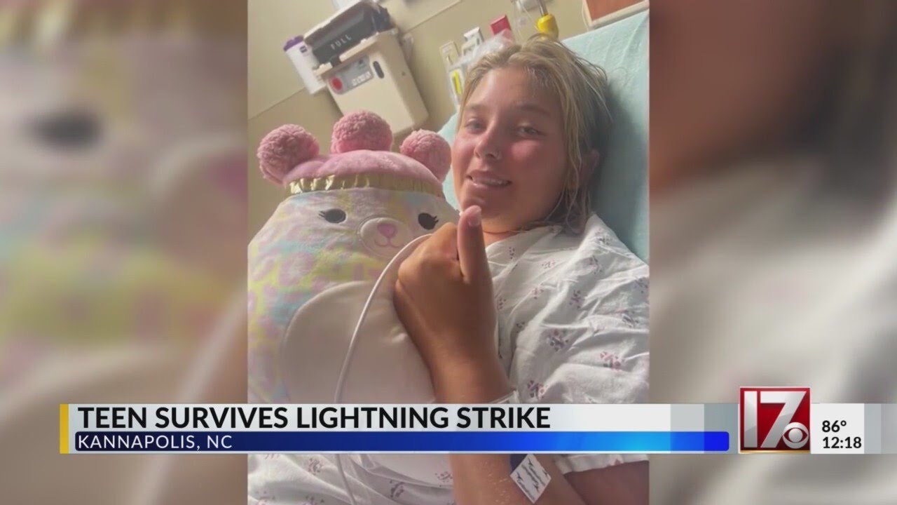 NC teenager survives being struck by lightning at pool - YouTube
