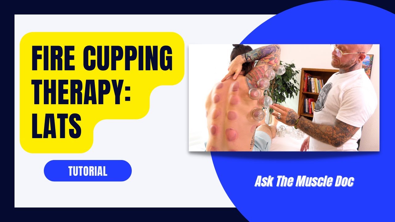 Dynamic Sports Cupping Therapy Tutorial: Latissimus Dorsi- Ask The ...