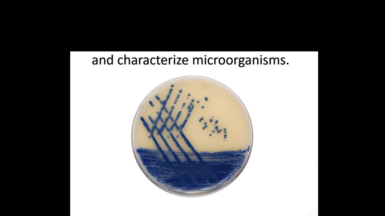 5 I's of Microbiology - YouTube