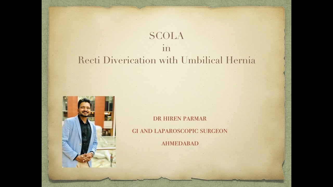 SCOLA- Subcutaneous Onlay Laparoscopic Approach - YouTube