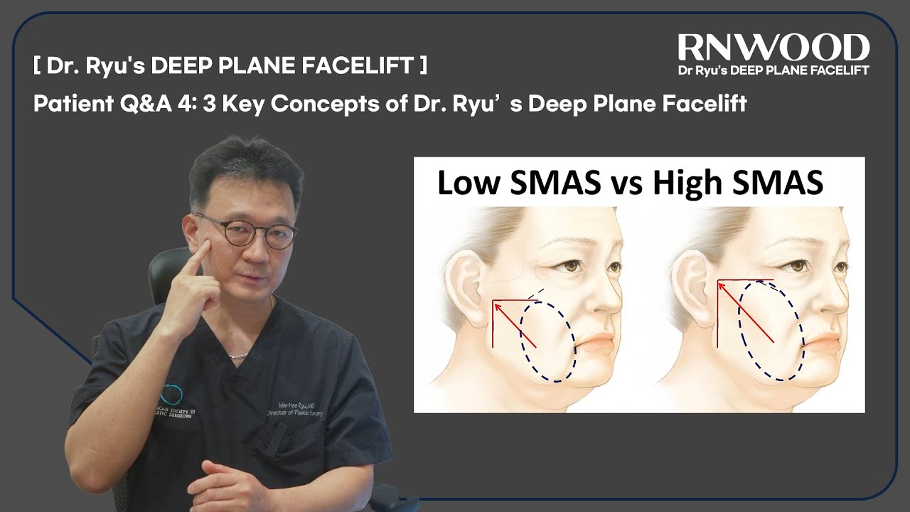 Patient Q&A 4: 3 Key Concepts of Dr Ryu’s Deep Plane Facelift - YouTube