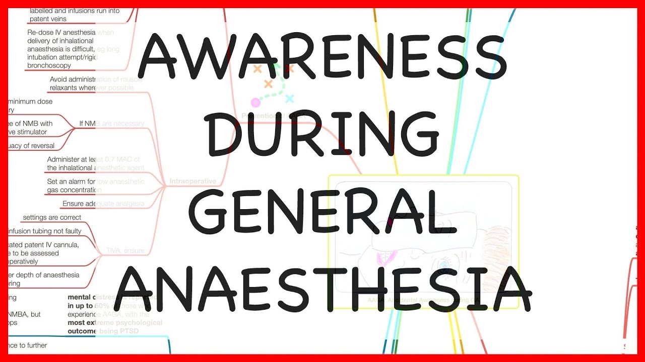 ACCIDENTAL AWARENESS DURING GENERAL ANAESTHESIA -PRACTICAL CONDUCT ...