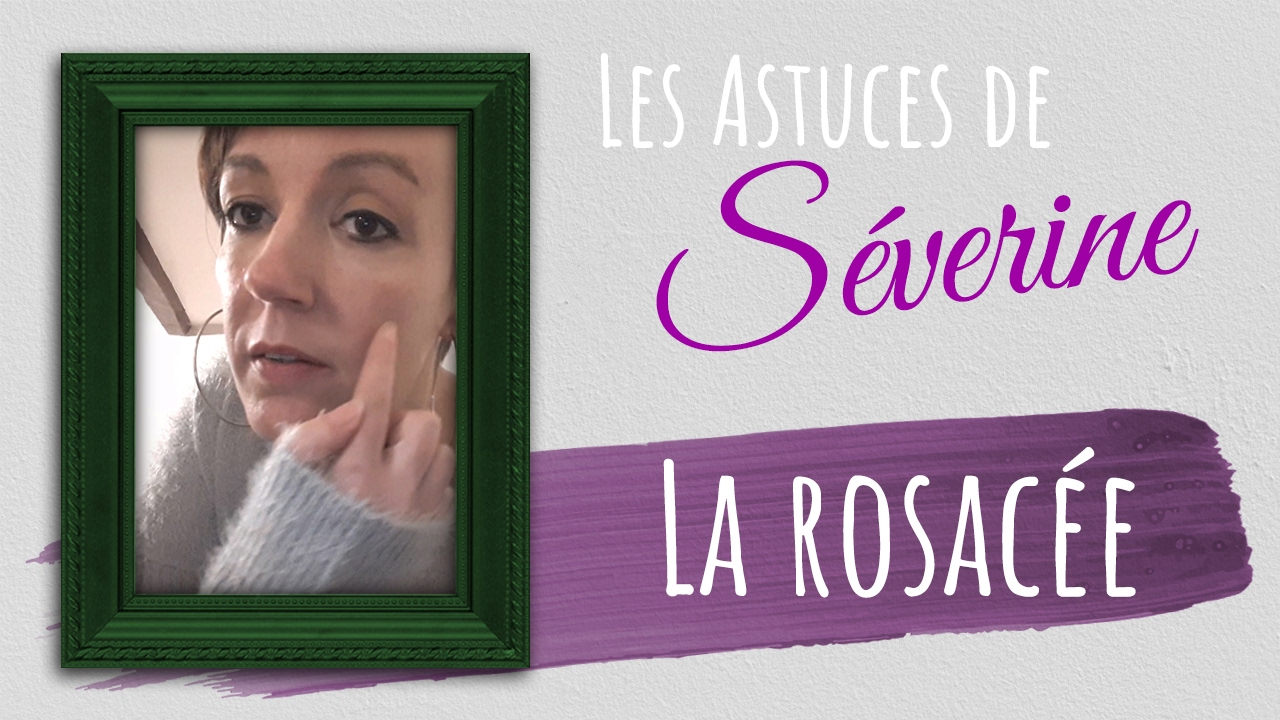 La rosacée ou couperose : symptômes et conseils - YouTube