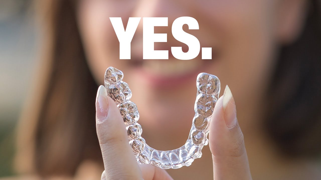 3 ways to get MORE patients to say YES to Invisalign (Part 1) - YouTube