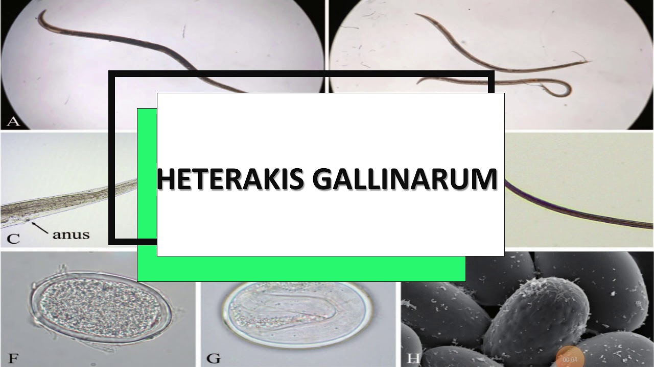HETERAKIS GALLINARUM - YouTube