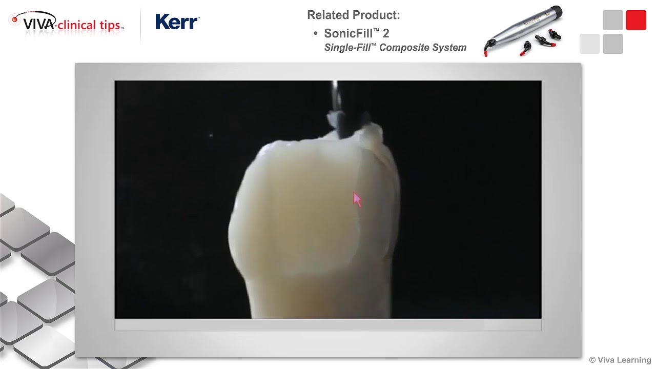 Dr. Harris on SonicFill 2 - YouTube