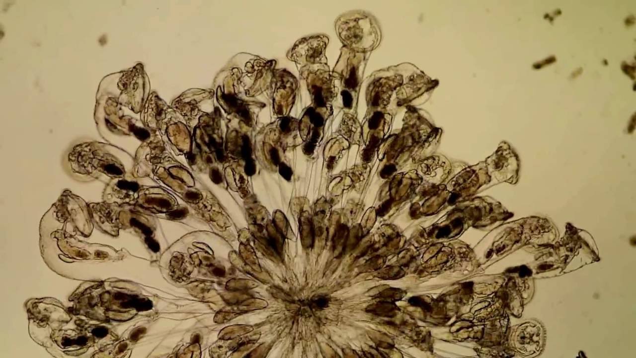 テマリワムシ Conochilus hippocrepis - YouTube