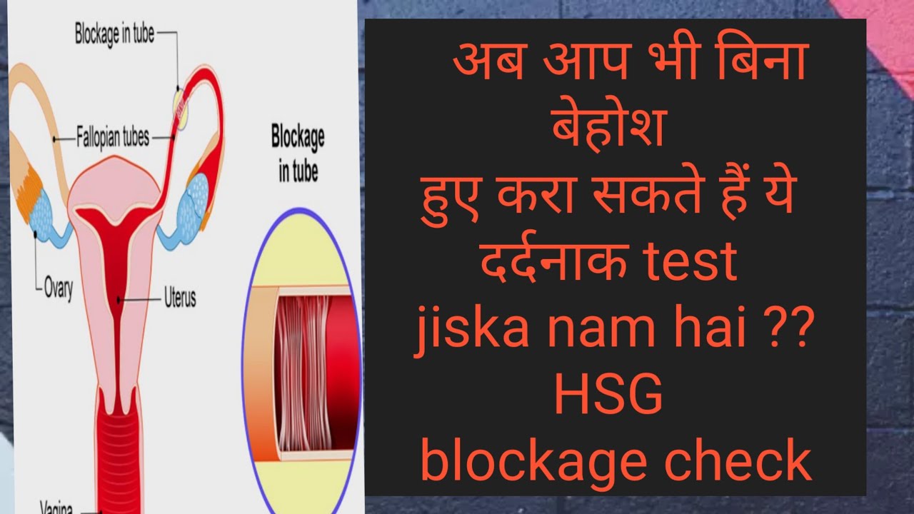 what is HSG test ??? experience sharing - YouTube