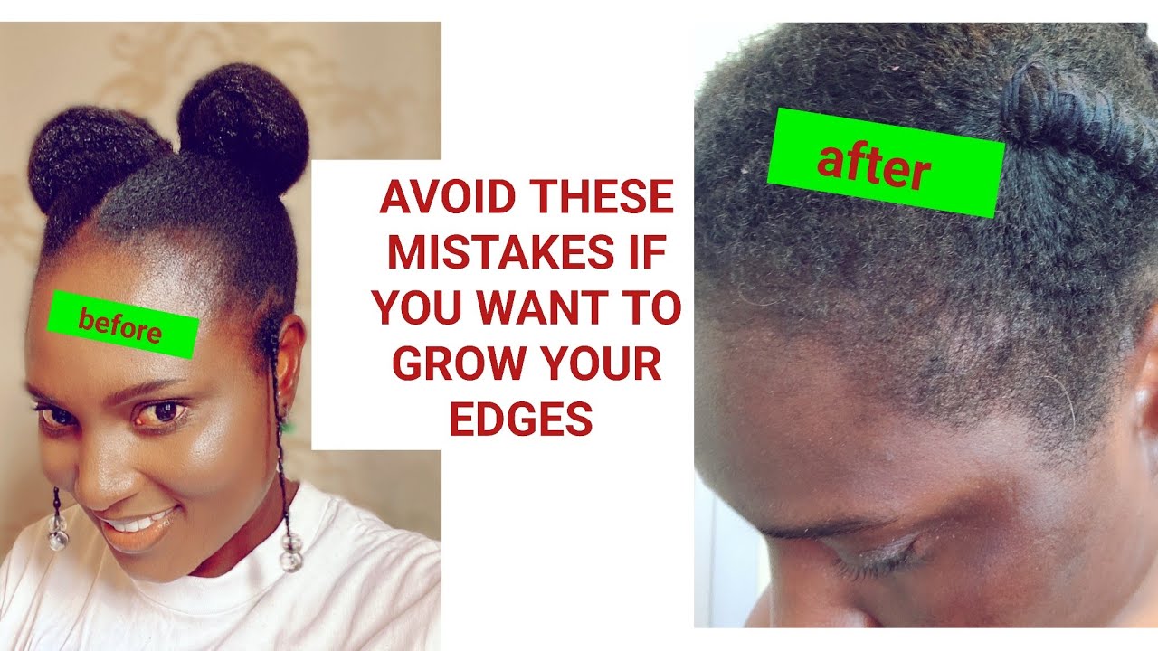 How To Grow Your Edges Back, Avoid these mistakes, fast hair growth ...