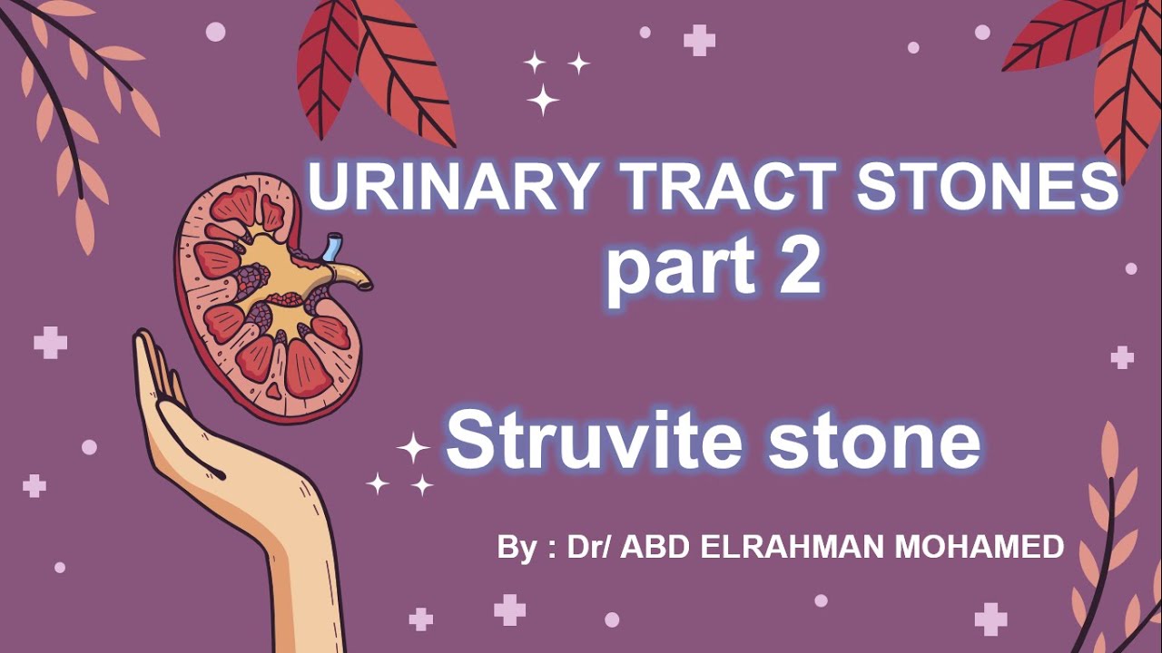 Struvite stone - حصوات الجهاز البولي في القطط و الكلاب الجزء الثاني ...