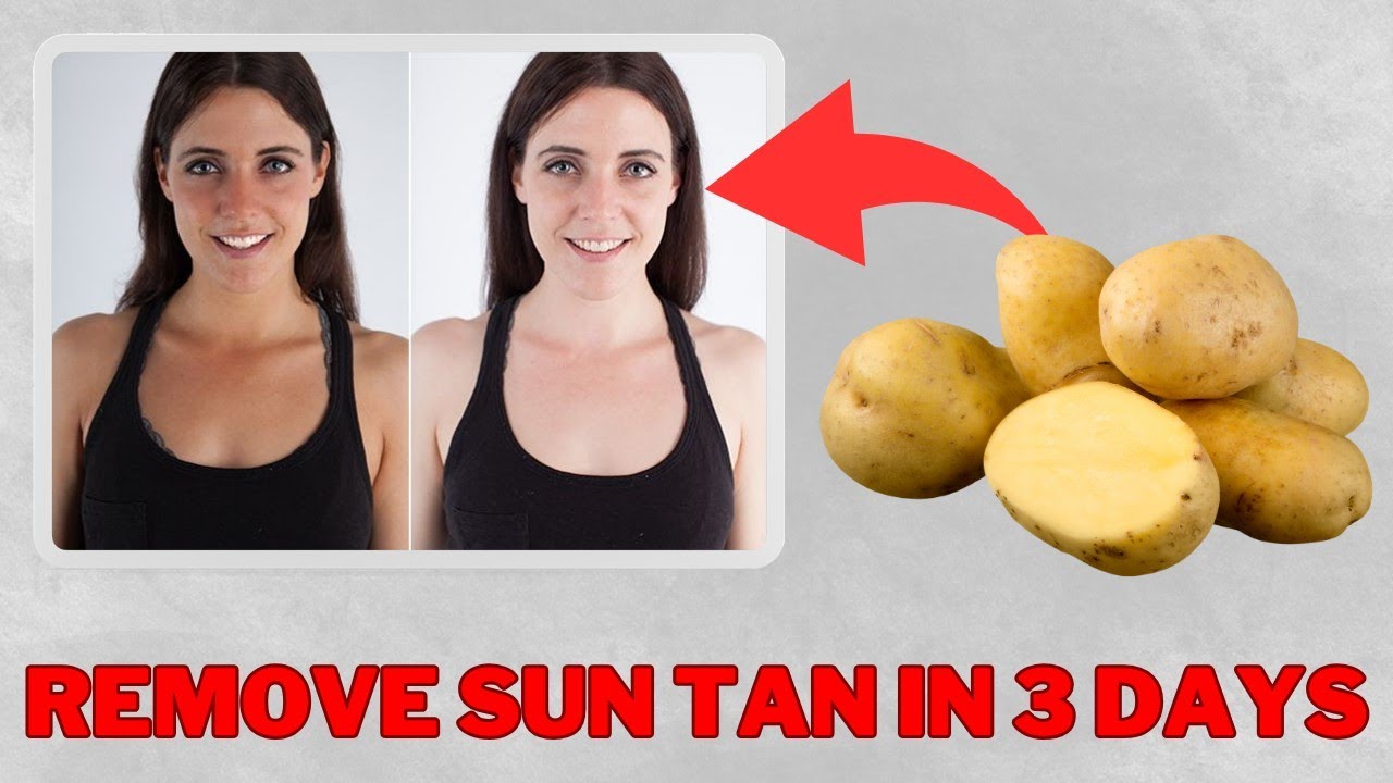 Say Goodbye to Sun Tan with These DIY Home Remedies | Skin Care Routine ...