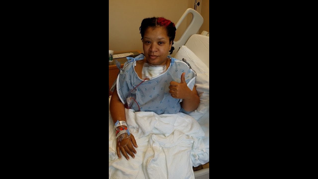 Thyroidectomy Diary Postop 9 Days YouTube thyroidectomy-diary-postop-9-days-youtube