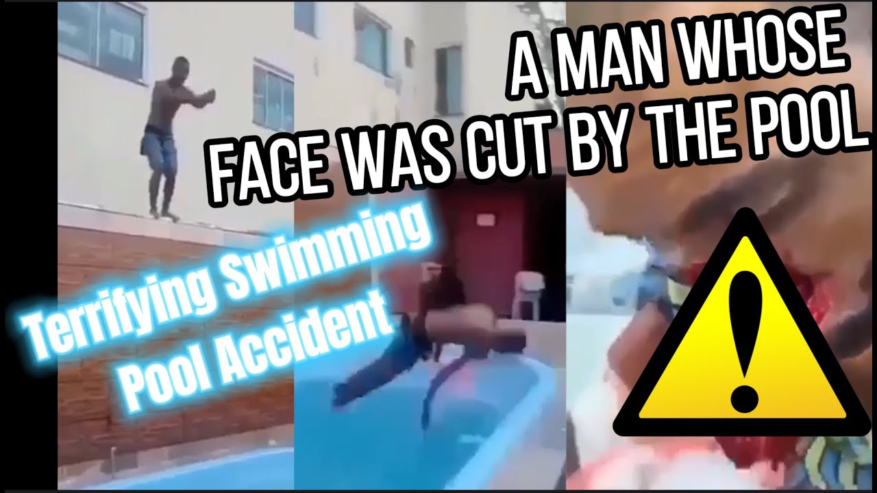 Terrifying Swimming Pool Accident | A man whose face cut by the pool ...