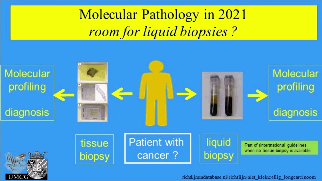 Detection of therapeutically targetable mutations in NSCLC: - YouTube