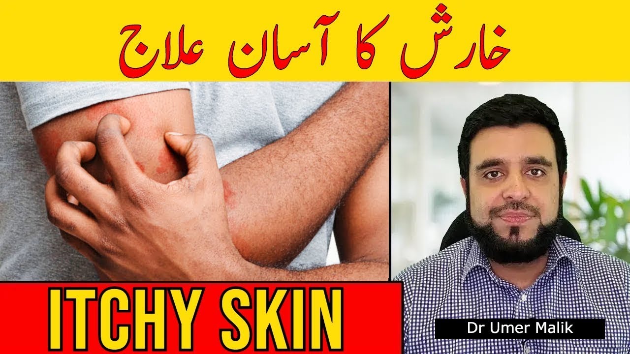 Itchy Skin: Kharish Ka Ilaj | Kharish Khatam Karne Ka Tarika | Khujli ...