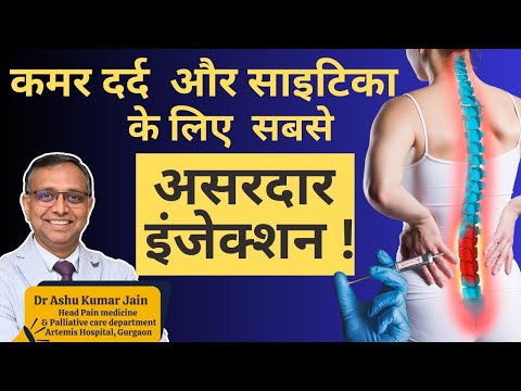 कमर दर्द और साइटिका के लिए कौन सा इंजेक्शन सबसे असरदार? जानिए सही इलाज!