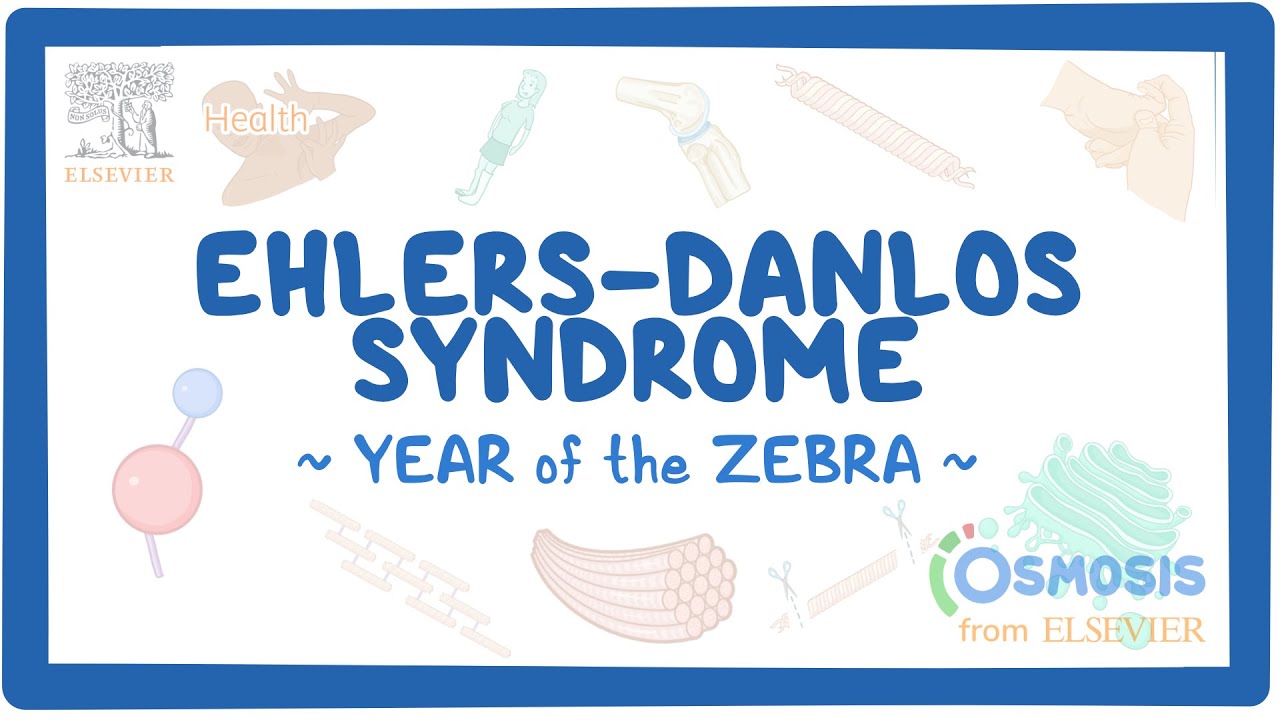 Ehlers-Danlos syndrome (Year of the Zebra) - YouTube