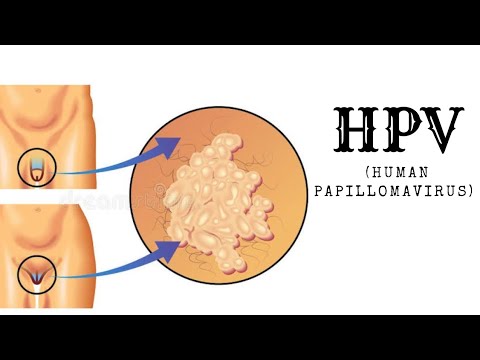 Everything about HPV (Human papillomavirus) - YouTube