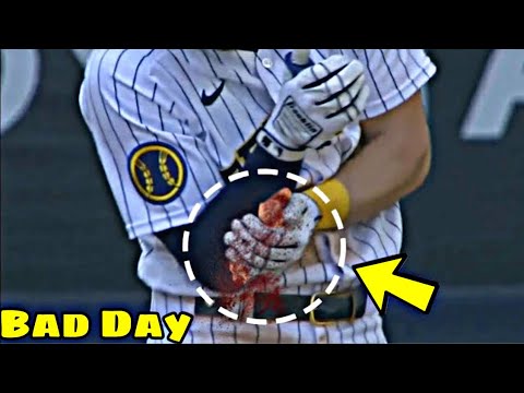 MLB | Bad Day (Hit By Pitch) - YouTube