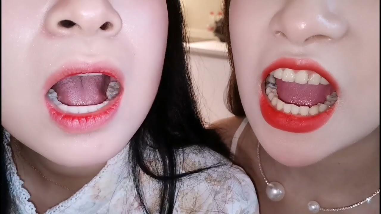 @口腔检查资源最新全部35r带走 - YouTube