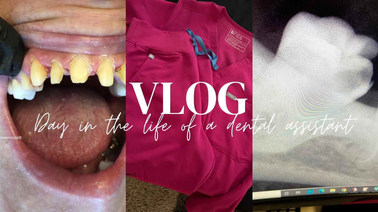 DAY IN THE LIFE OF A DENTAL ASSISTANT YouTube day-in-the-life-of-a-dental-assistant-youtube