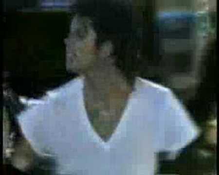 Michael Jackson Vitiligo