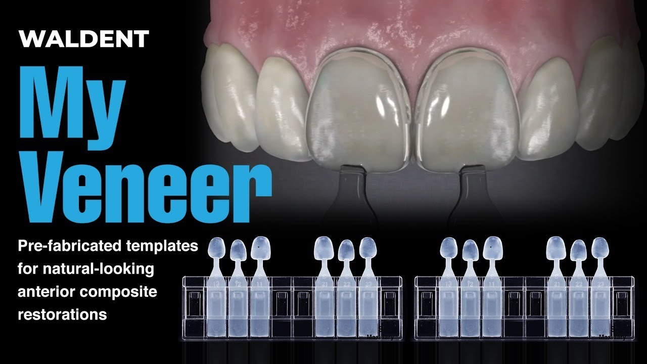 Pre-fabricated templates for natural-looking anterior composite ...