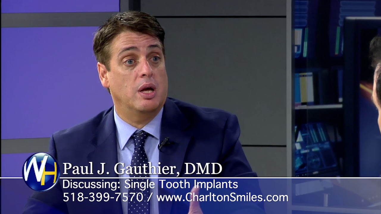 Single Tooth Implants with Charlton, NY dentist Paul J. Gauthier, DMD ...