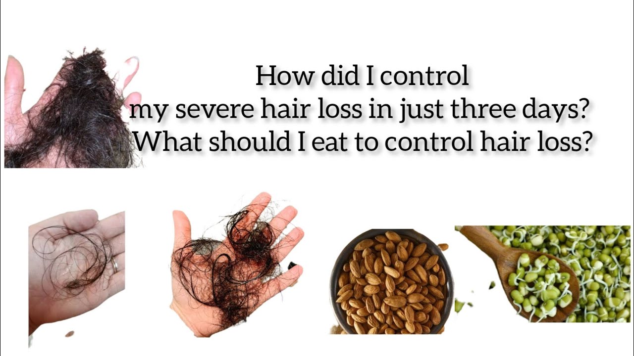 How did I control my severe hair loss in just three days? # ...