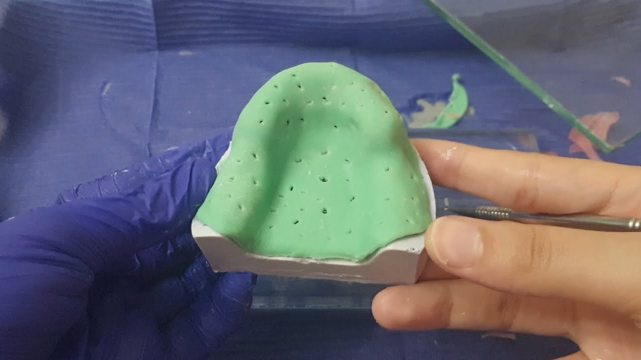 special tray for partial denture with tips💥🦷 and tricks 💥 - YouTube