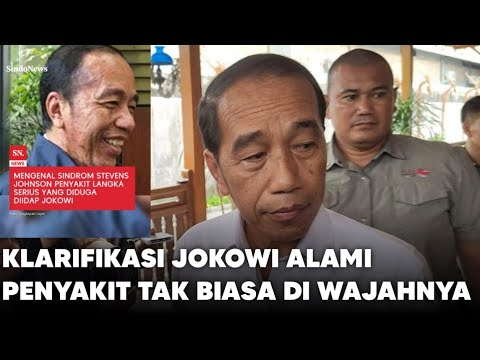 Klarifikasi Ajudan JOKOWI, Soal Diduga Alami PENYAKIT LANGKA PADA WAJAHNYA - YouTube