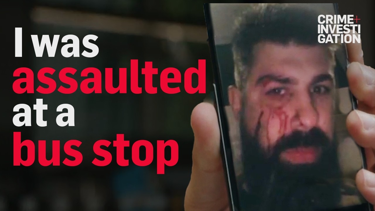 The Painful Story Behind My Scar | True Crime Secrets - YouTube