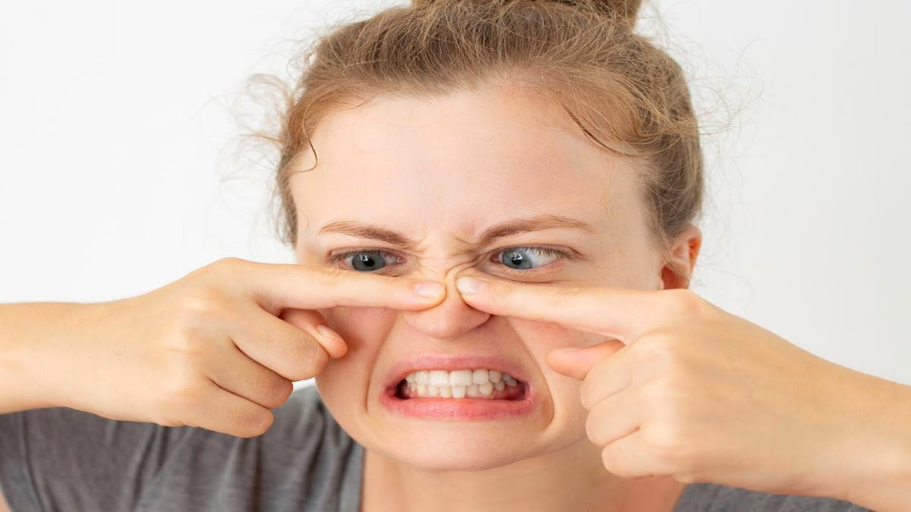 CRAZY Popping huge blackheads and Pimple Popping - BEST Pimple Popping ...