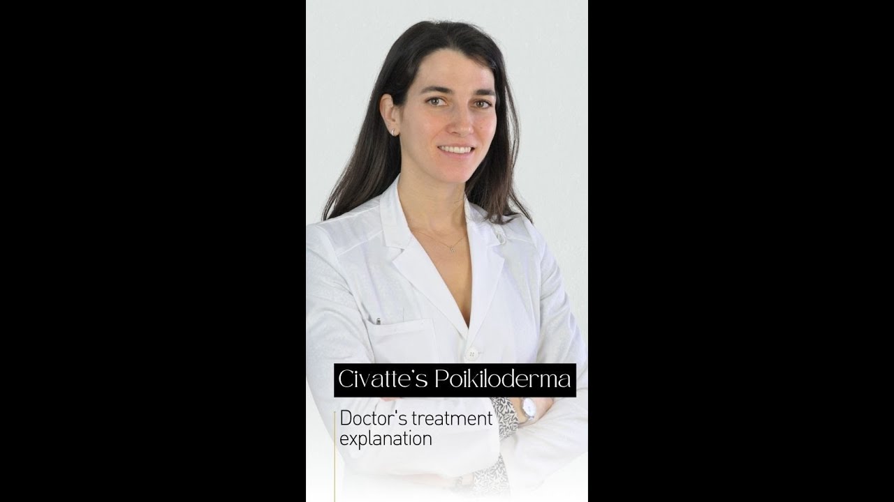 Laser Treatment for Poikiloderma of Civatte: Effective Solutions for ...