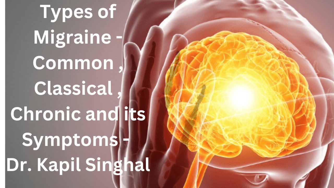 Types of Migraine - Common , Classical , Chronic and its Symptoms - Dr ...