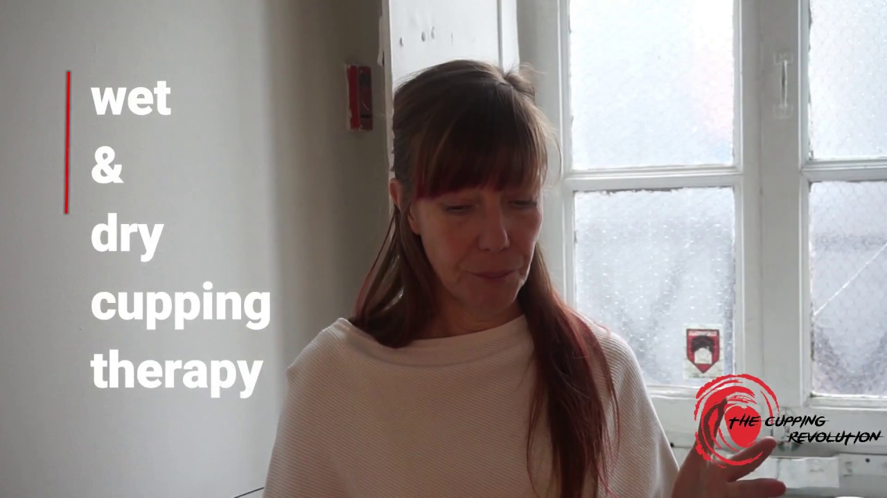 Cupping Techniques: Wet & Dry cupping - YouTube
