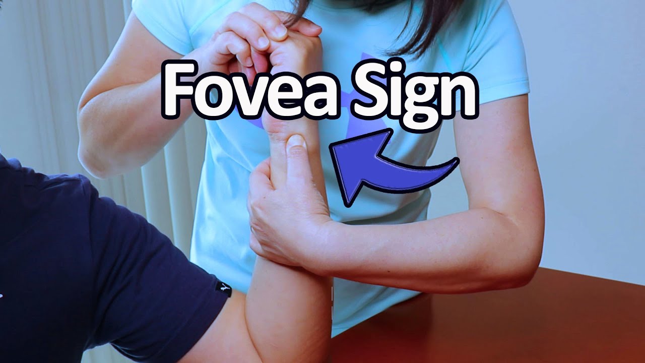 Fovea Sign - YouTube