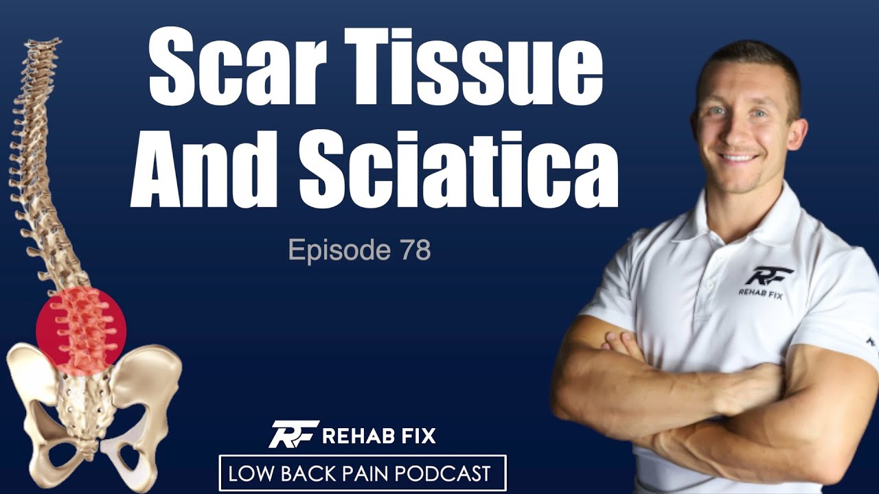Scar Tissue and Sciatica | Low Back Pain Podcast #78 - YouTube