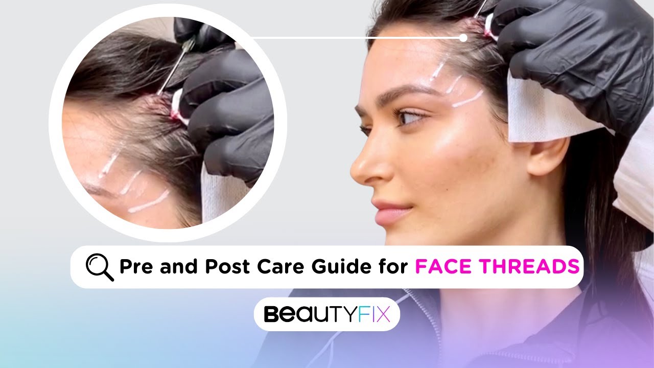 What To Do AFTER PDO Threads? | BeautyFix - YouTube