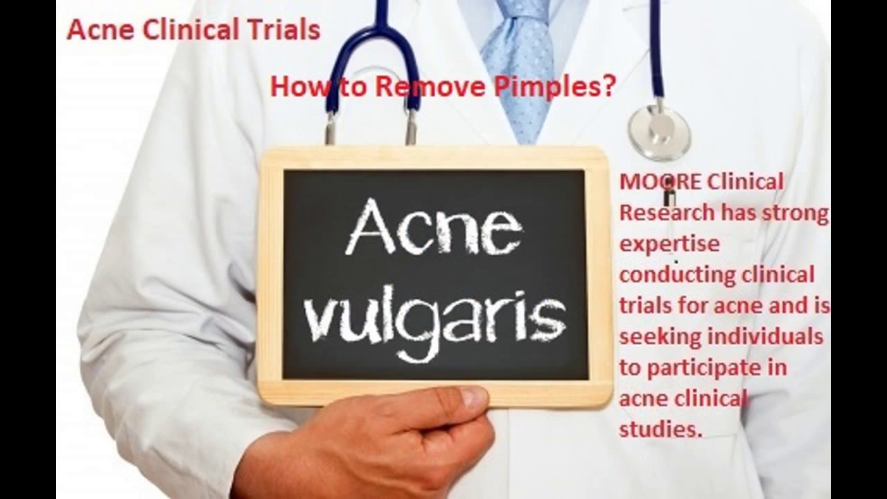 Acne Research Study - Acne Vulgaris Miami | ARDS Clinical Trials Video ...